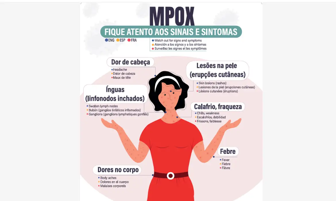 Secretaria de Saúde confirma segundo caso de mpox do grupo lp em SP